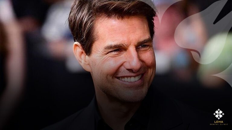 How To Get Teeth Like Tom Cruise - Lema Clinic