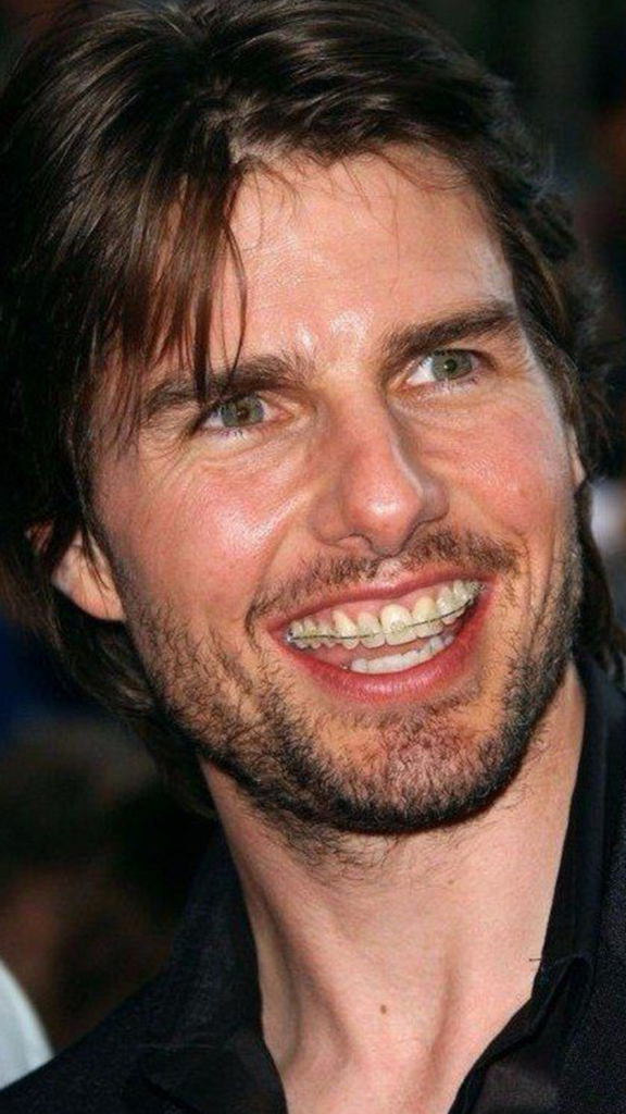 Tom Cruise Teeth - How To Get Teeth Like Tom Cruise? 💫
