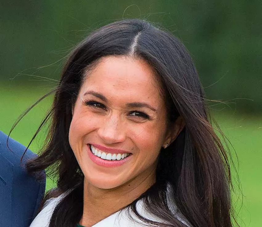 Meghan Markle Smile Transformation