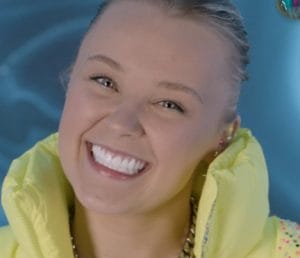 Jojo Siwa New Teeth Now: Before and After Veneers | 2025 Price!