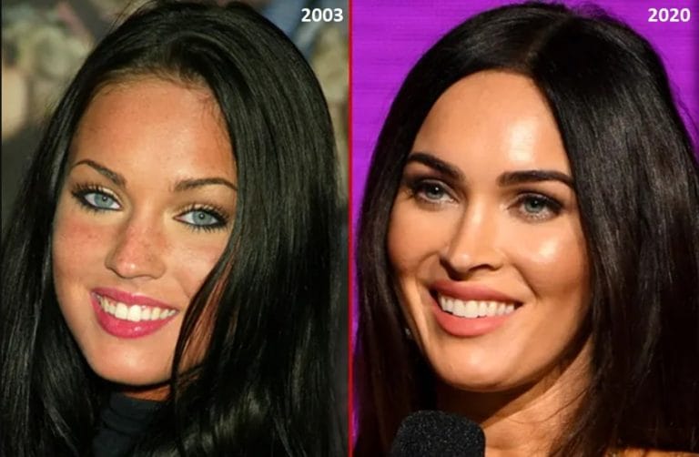 😄 Megan Fox Şimdi Yeni Dişlerle: İmplant Öncesi ve Sonrası!