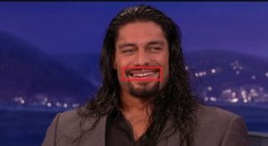 Roman Reigns New Teeth Now: Porcelain Veneers Before After | LEMA