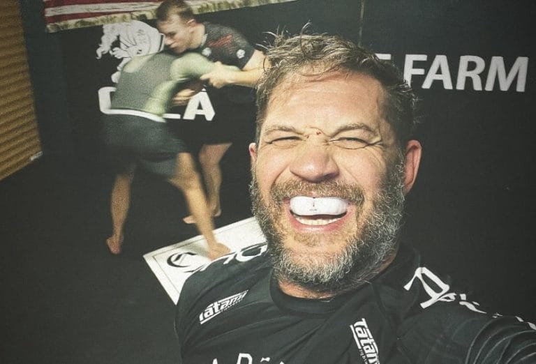 Tom Hardy New Teeth Now: Hollywood Smile Before After | LEMA