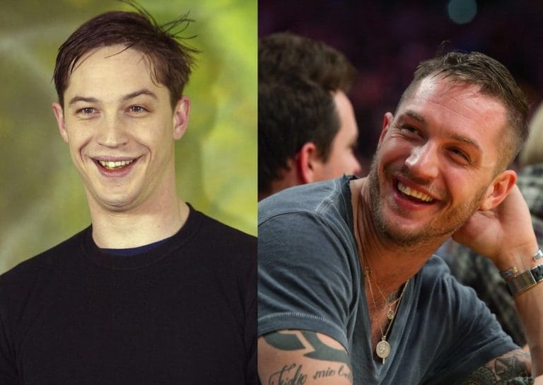 😁 Les nouvelles dents de Tom Hardy