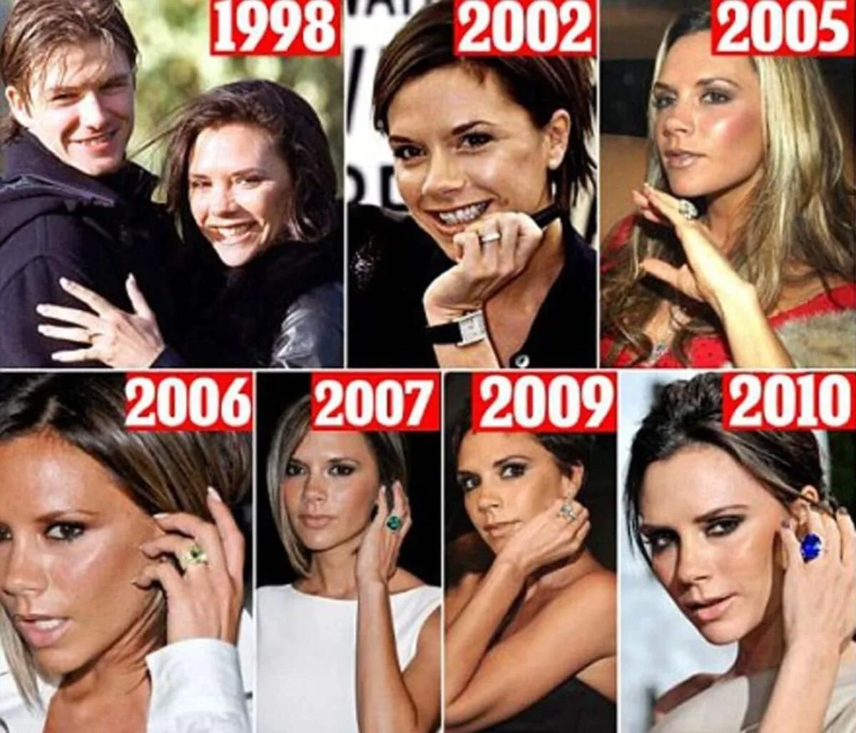 Victoria Beckham New Teeth Now: Before and After Implants!