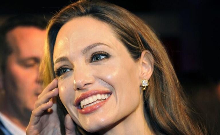 🦷 Angelina Jolie Teeth (Old/New): Before and Afters! | LEMA