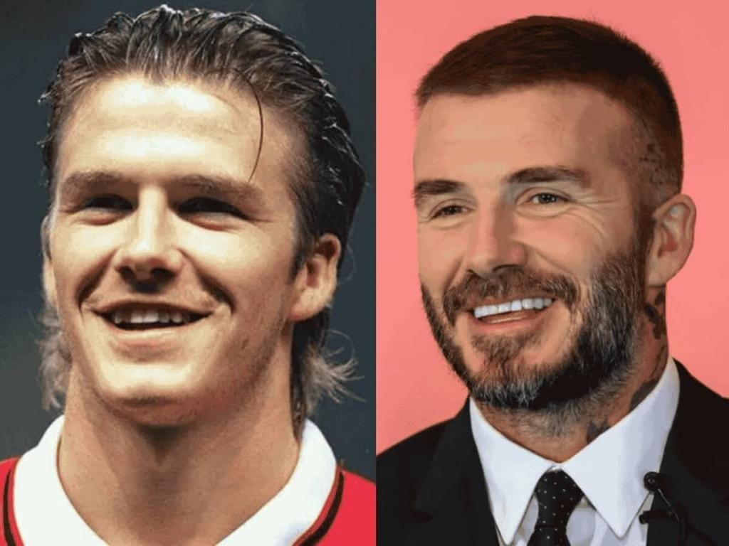 🦷 Los dientes de David Beckham cambiaron