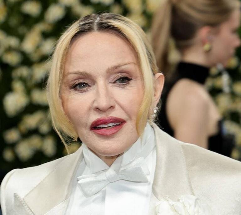🧚‍♀️ Madonna Teeth (Old/New): Before and Afters | LEMA