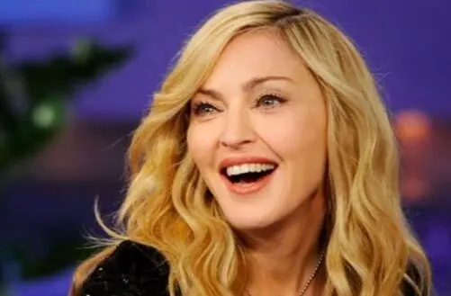 🧚‍♀️ Madonna Teeth (Old/New): Before and Afters | LEMA