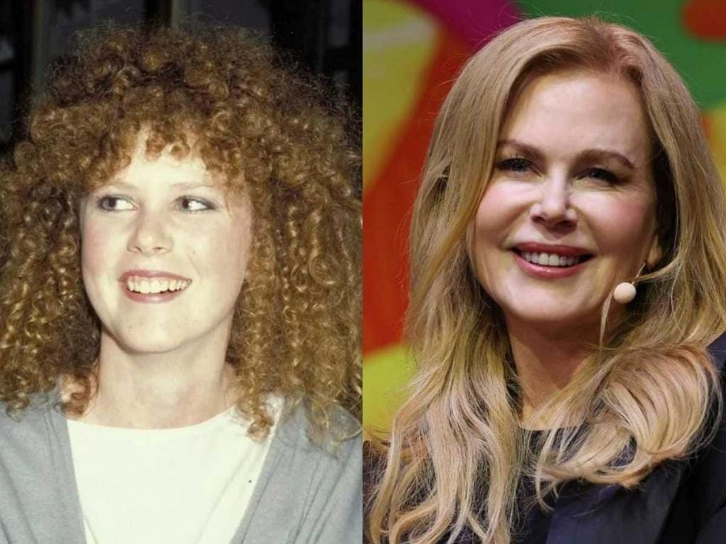 🦷 Nicole Kidman's Teeth Transformation Before/After | LEMA