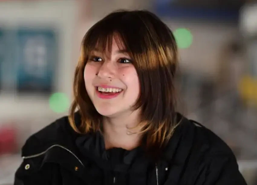 Alysa Liu's Teeth Transformation: Before and After | LEMA