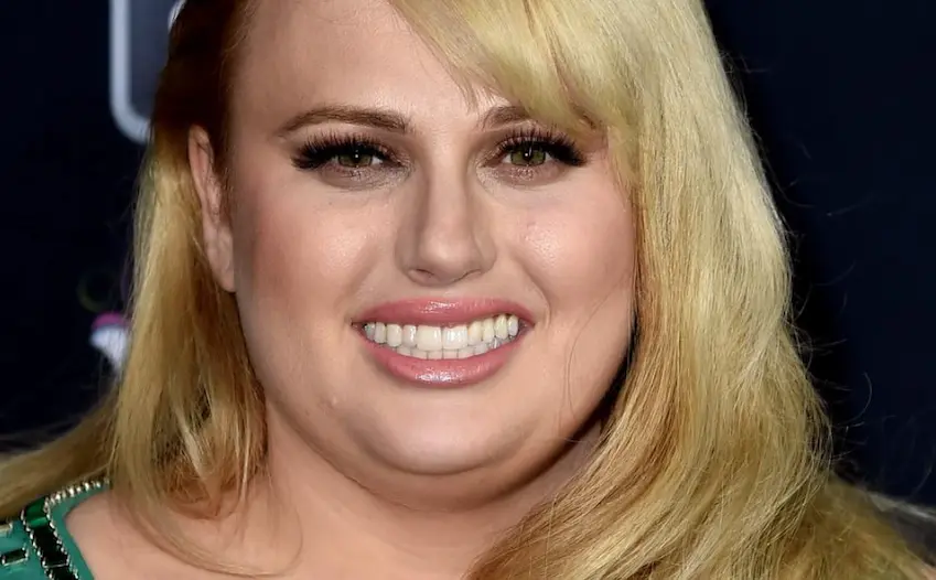 Rebel Wilsons nye tannforvandling