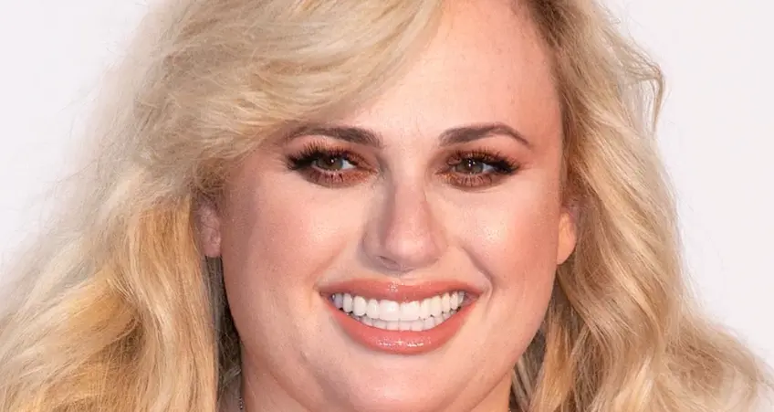 Rebel Wilson's New Teeth Transformation | LEMA