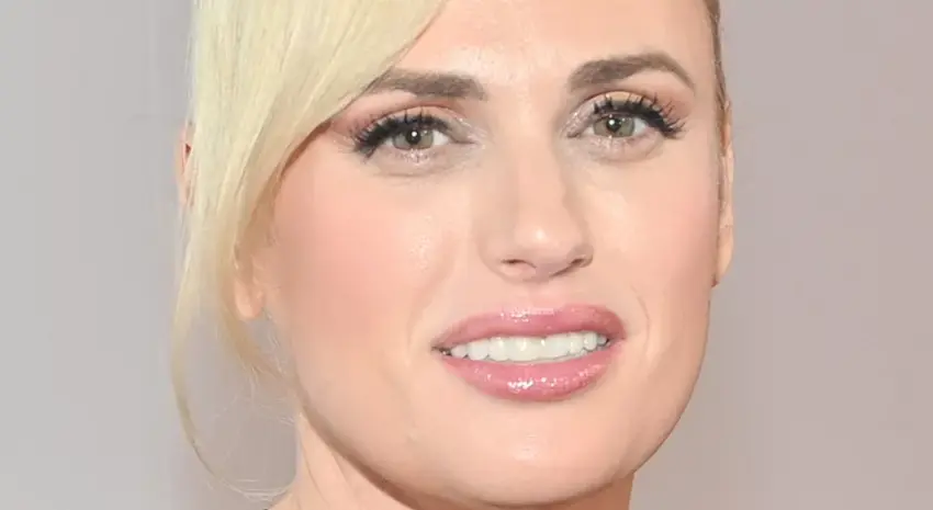 La nuova trasformazione dei denti di Rebel Wilson | Lema Dental Clinic