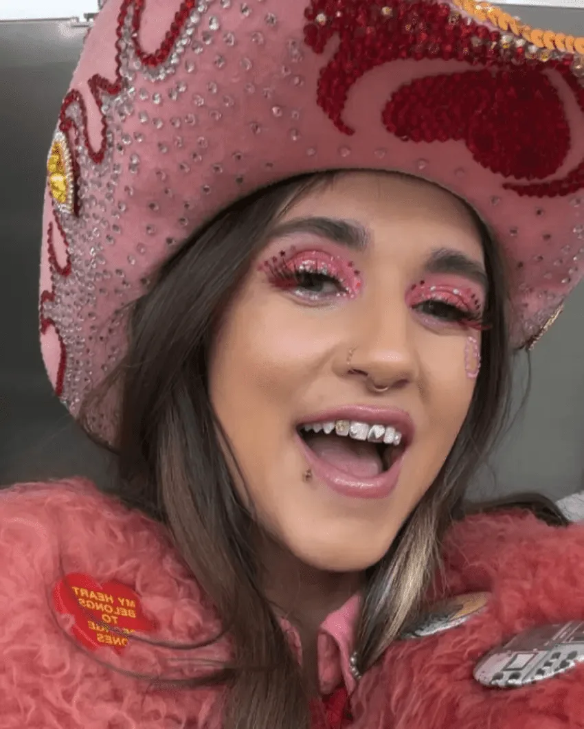 Sierra Ferrell's Teeth: Before & Afters | LEMA