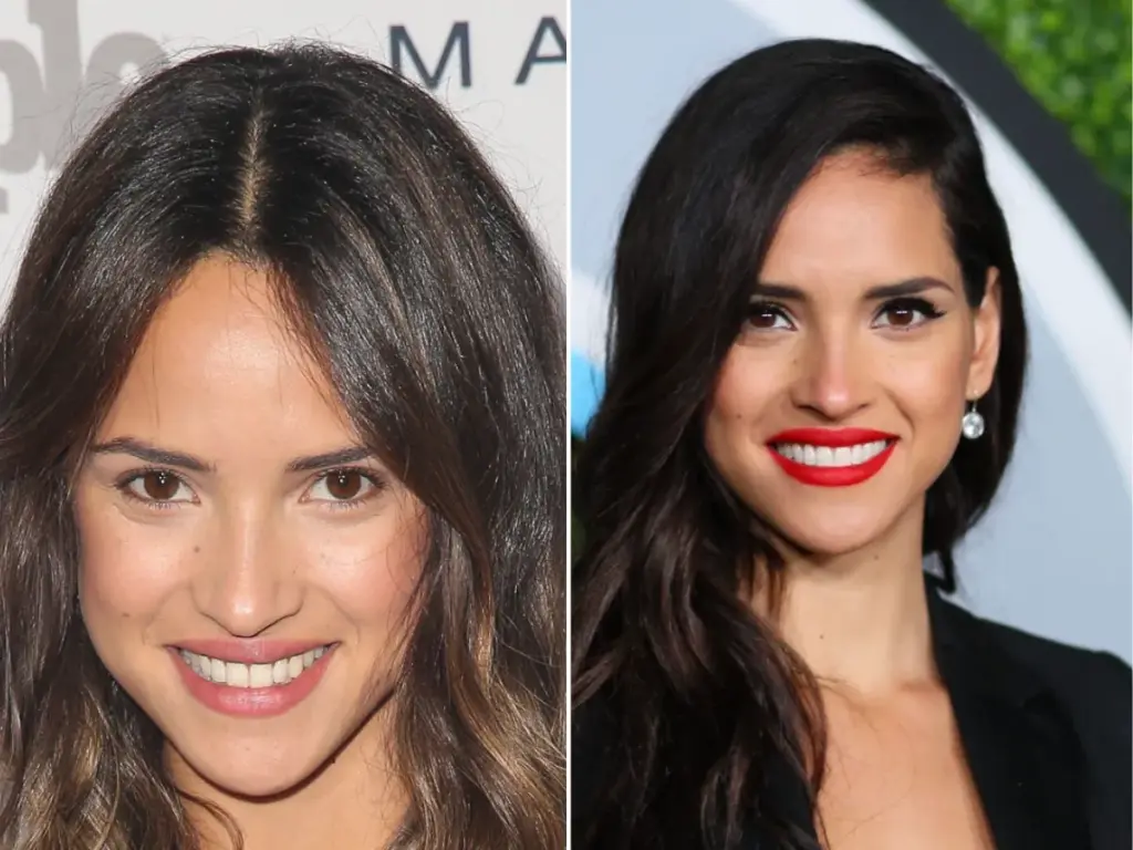 Transformation na усмивката на Adria Arjona