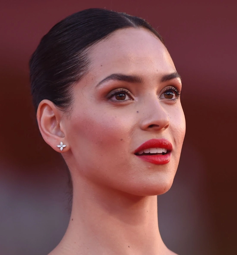 Adria Arjona’s Smile Transformation: A Natural-Looking Makeover | LEMA