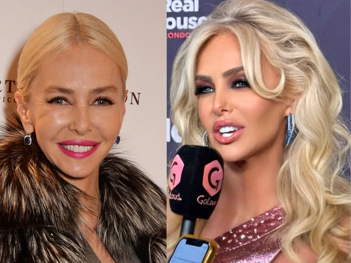 Amanda Caroline Cronins Tänder Före och Efter