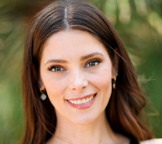 Ashley Greene's Glowing Smile | LEMA