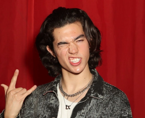 Conan Gray's Teeth Transformation | LEMA