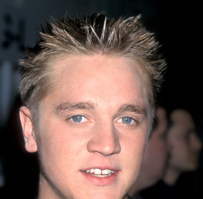 🦷 Devon Sawa Tanden (Oud/Nieuw): Voor en Na foto's