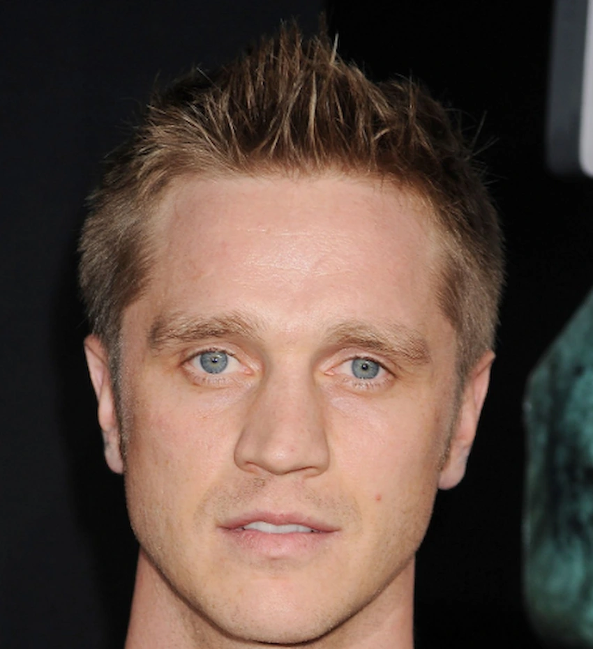 🦷 Devon Sawa Dişleri (Eski/Yeni): Önce ve Sonra | Lema Dental Clinic