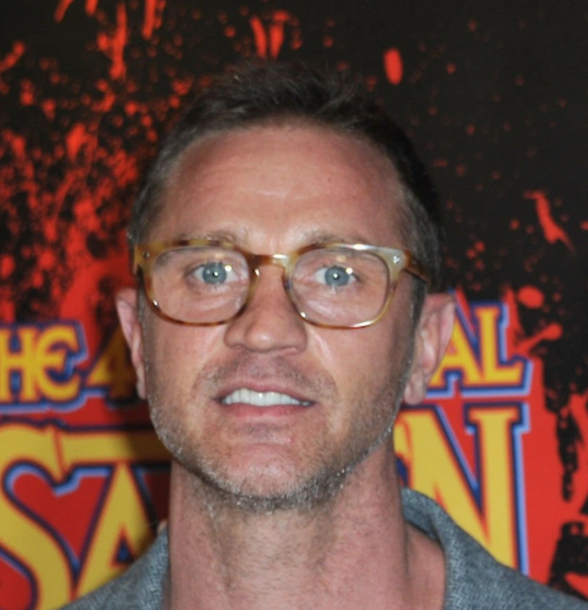 🦷 Devon Sawa Teeth (Old/New): Before and Afters | LEMA