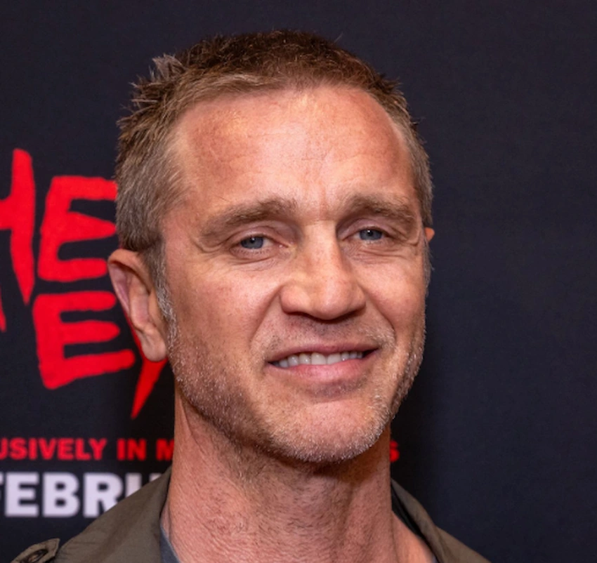 🦷 Devon Sawa Teeth (Old/New): Before and Afters | LEMA