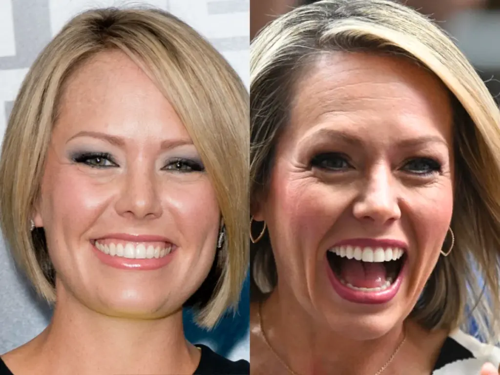 🎙️ Dylan Dreyer Ankündigung: Ihre Zähne Damals und Heute | Lema Dental Clinic