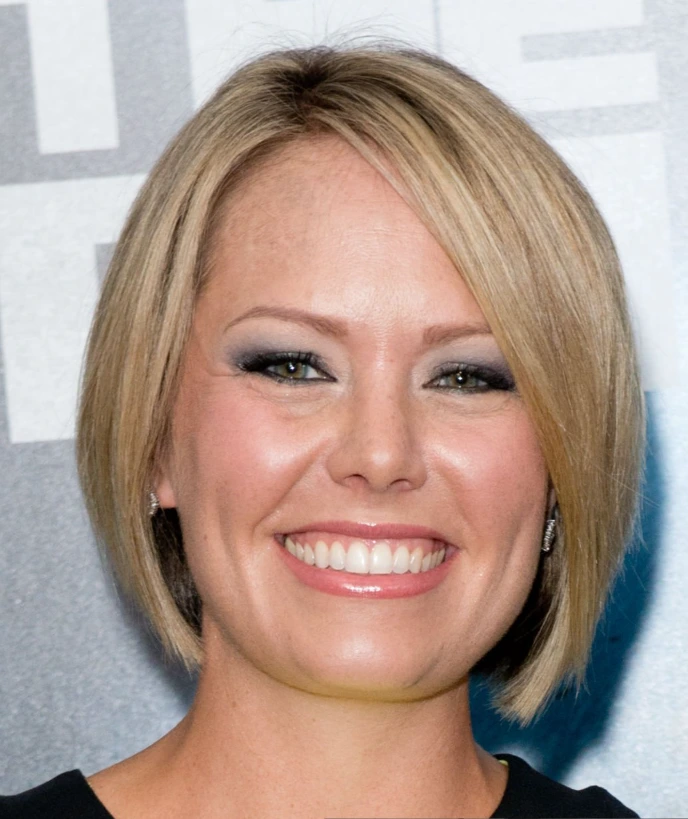 🎙️ Dylan Dreyer Announcement: Her Teeth Then and Now | LEMA