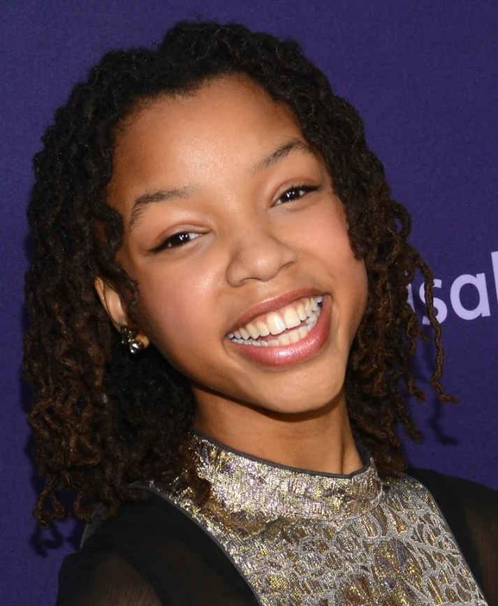 Dinți Noi ai lui Halle Bailey: Înainte și După | Lema Dental Clinic
