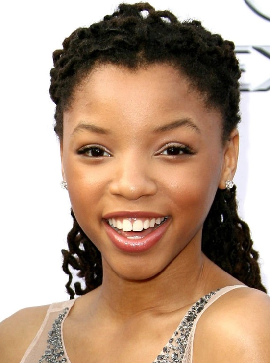 🤩 Halle Bailey’s New Teeth Then Now – Before and After | LEMA