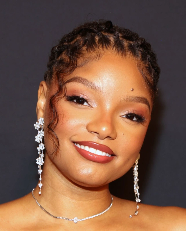 🤩 Halle Bailey’s New Teeth Then Now – Before and After | LEMA