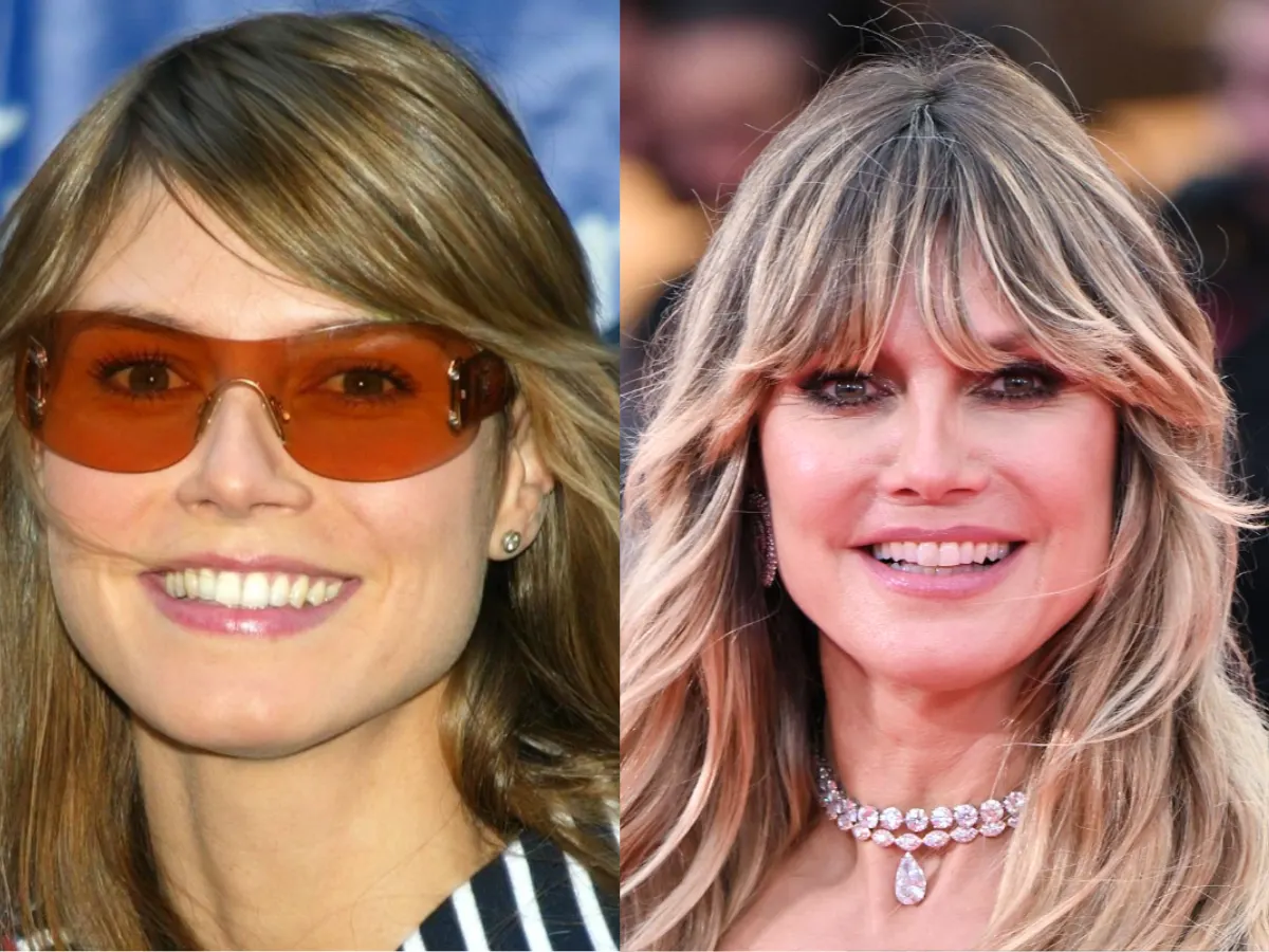Heidi Klum’s New Teeth Now - Perfect Transformation | LEMA