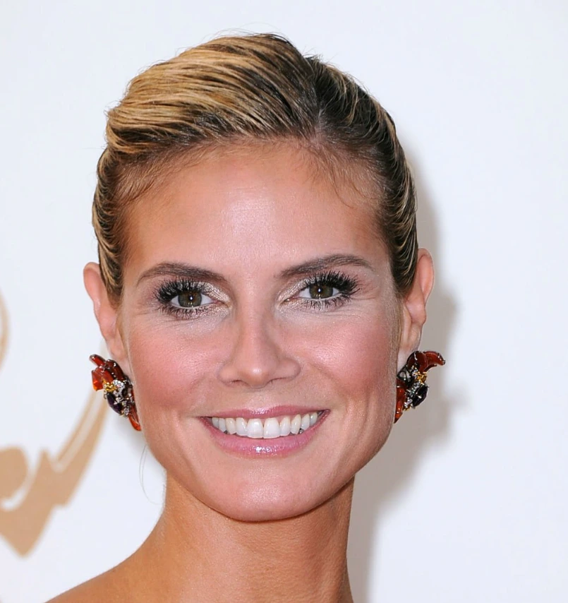 Heidi Klum’s New Teeth Now - Perfect Transformation | LEMA