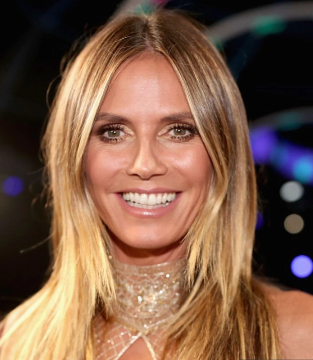 Heidi Klum nauji dantys dabar - tobulas transformavimas