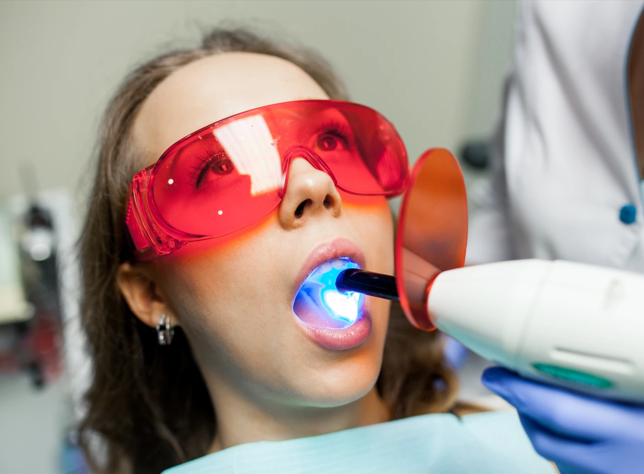 Internal Teeth Whitening: Effective Treatment | LEMA