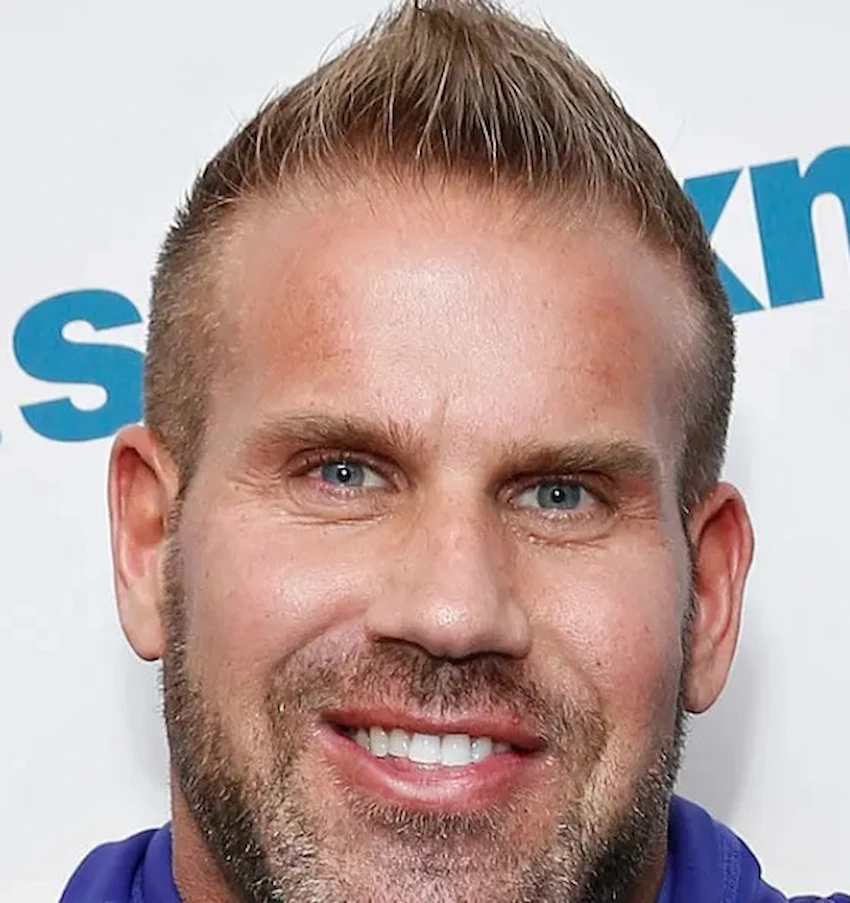 Transformacja zębów Jay Cutlera: przed i po