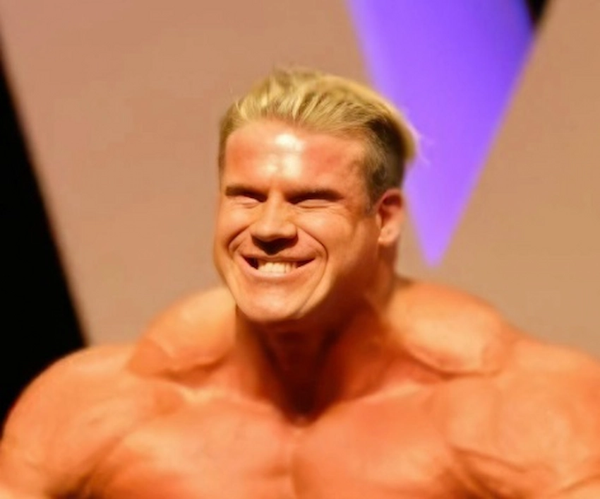 Transformation des dents de Jay Cutler : Avant et Après | Lema Dental ...