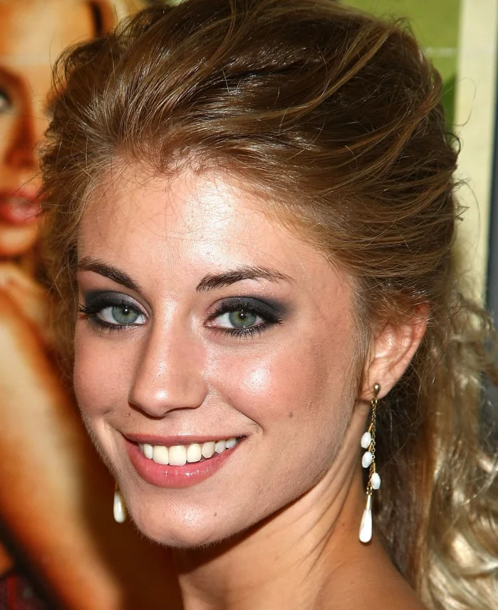 Peacemaker Star Jennifer Holland’s Smile Transformation | LEMA