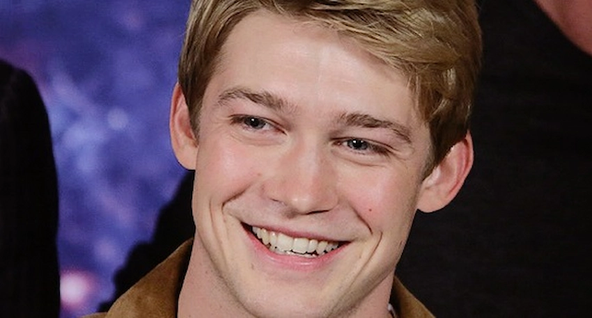 Joe Alwyn Teeth: Elegance and What Can Be Done? | LEMA