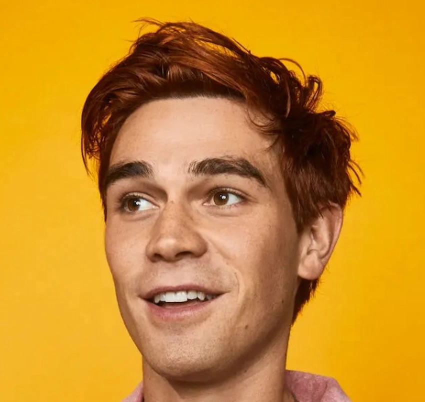 Transformación Dental de KJ Apa: Antes y Después | Lema Dental Clinic