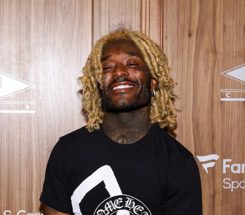 Lil Uzi Vert Dantų Pokyčiai: Prieš ir Po