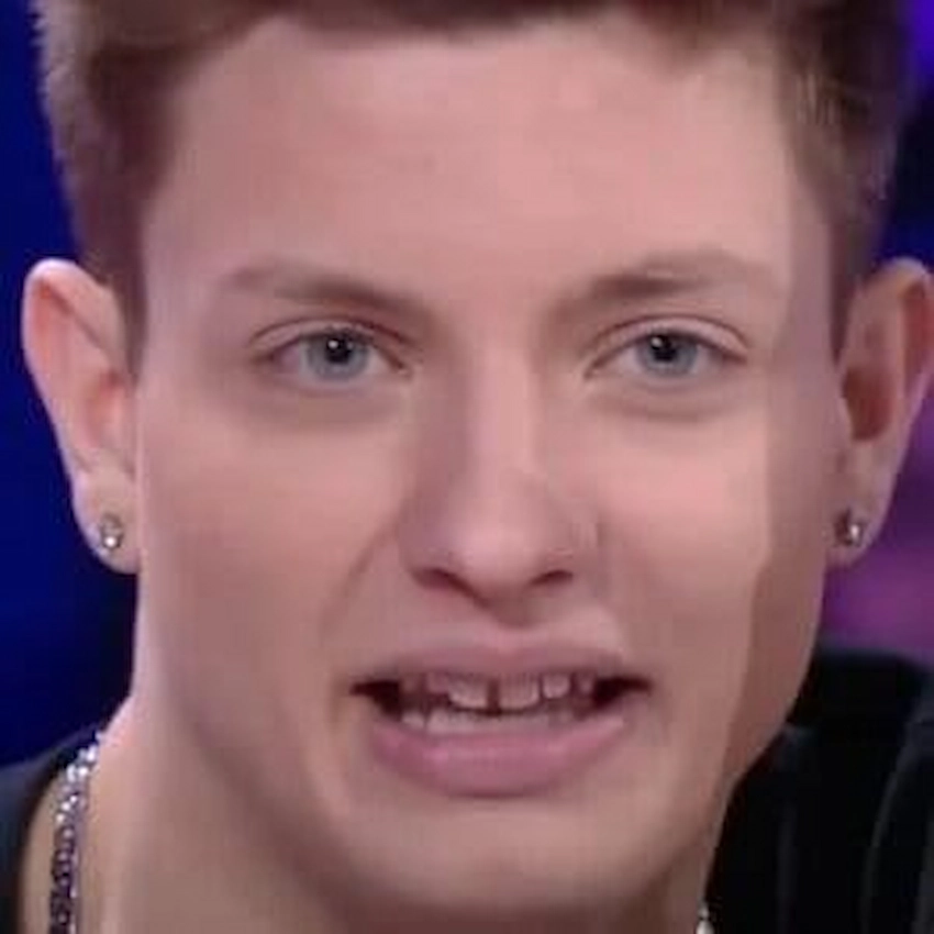 🤨 Matt Rife Teeth (Old/New): Before and Afters | LEMA