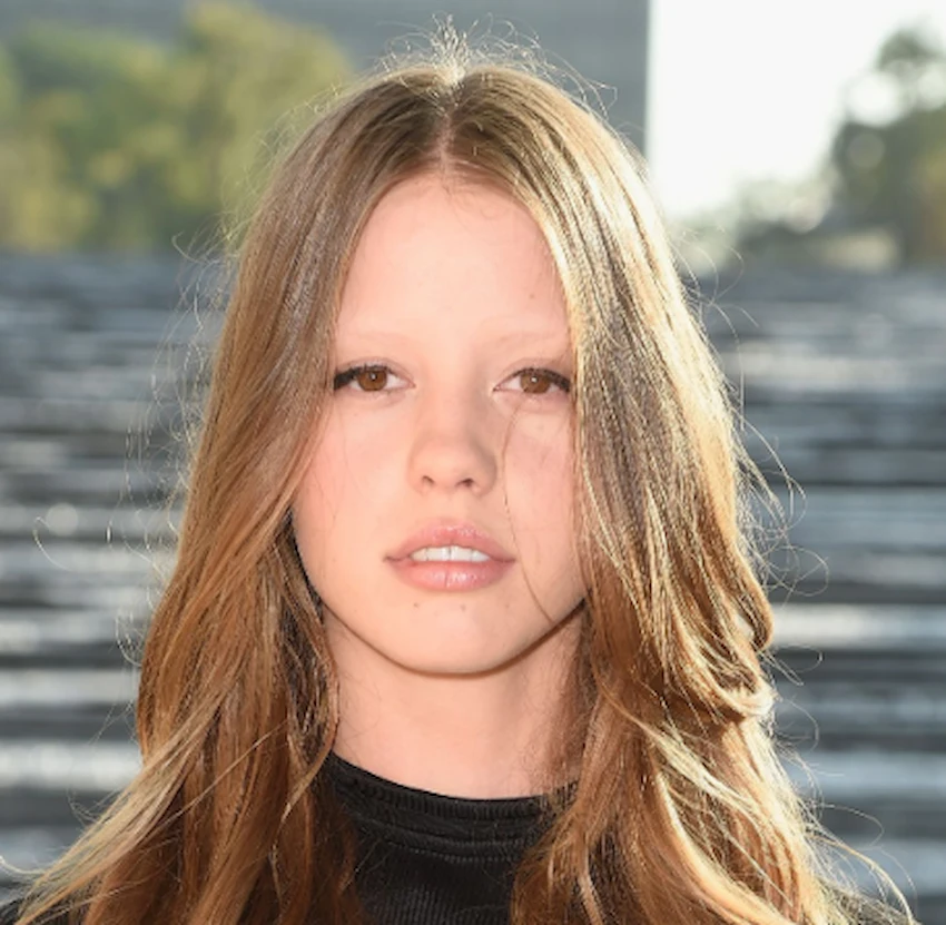 🤩 Mia Goth Dişleri (Eski/Yeni): Önce ve Sonra | Lema Dental Clinic
