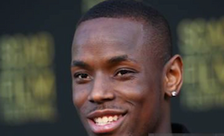 🦷 Michael Ward Ngipon Nga Gitama Na Ba? Mga Antes ug Human