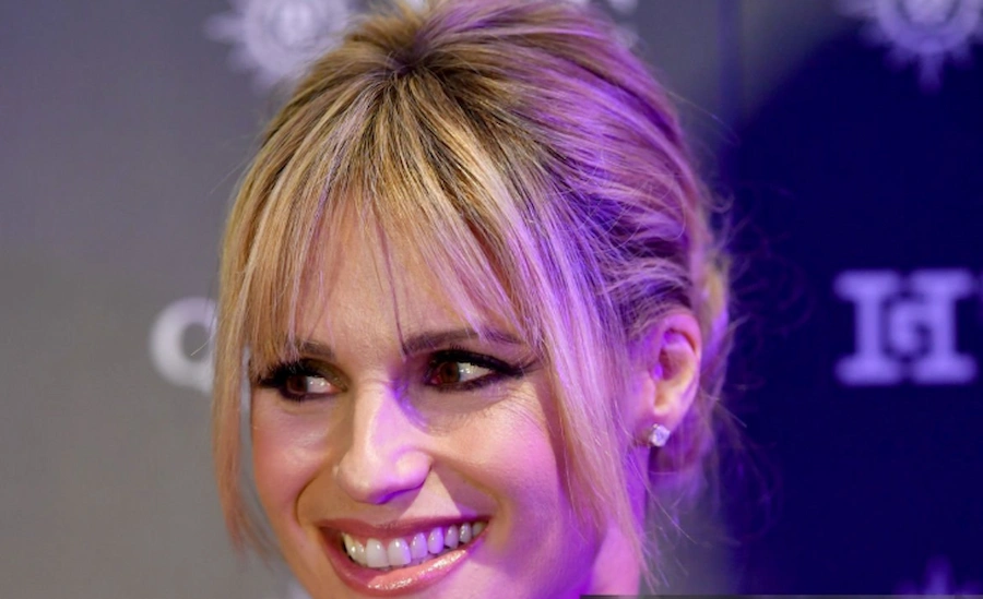 Britney Spears New Teeth: Before After Comparison 2025! - LEMA