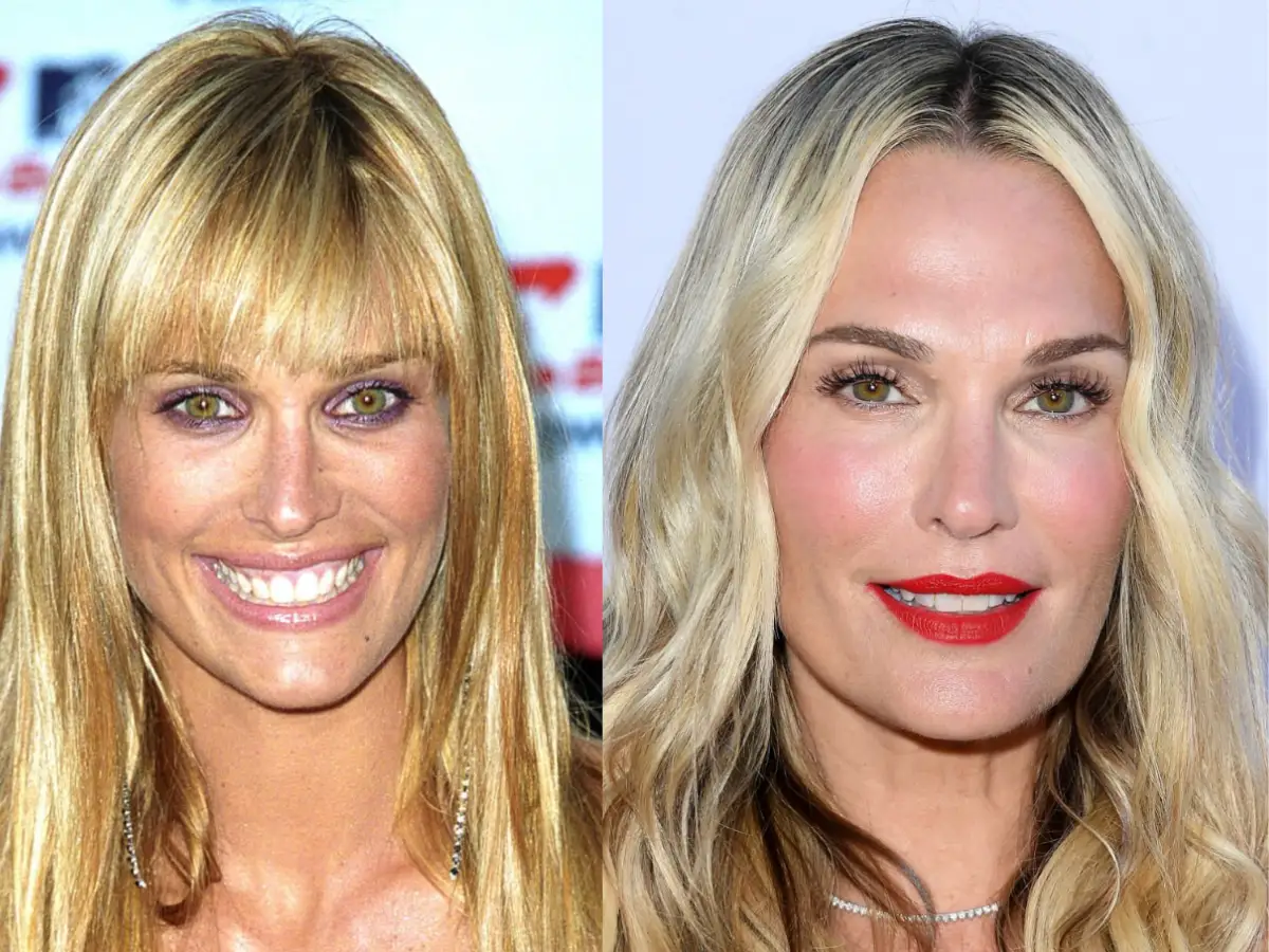 🦷How Long Should I Avoid Coffee After Dental Surgery? | LEMA