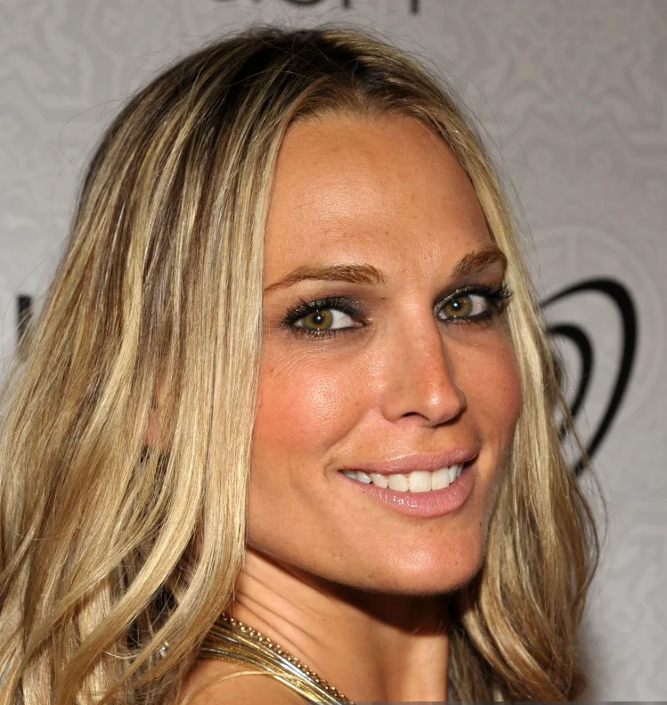 Nuevos dientes de Molly Sims ahora - Antes y después | Lema Dental Clinic