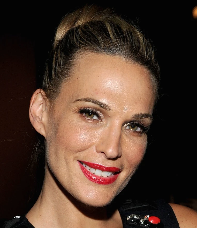 Molly Sims’ New Teeth Now - Before and After | LEMA